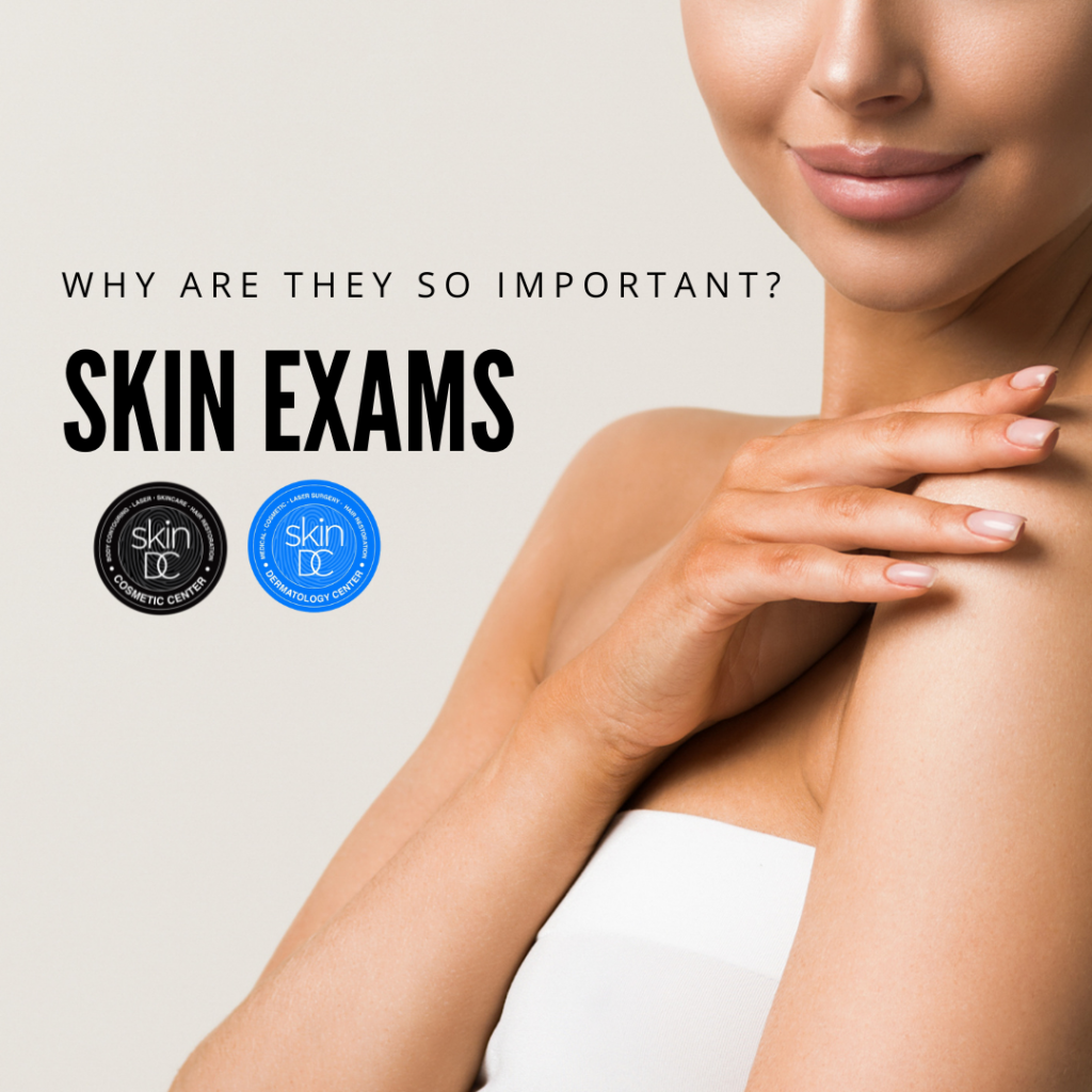 Why are skin exams so important? | SkinDC | Skin Cancer