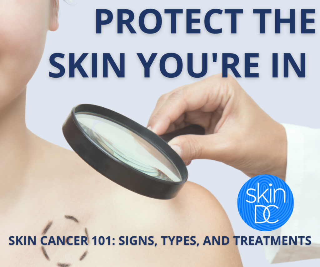 Skin Cancer 101: Signs, Types and Treatments | SkinDC | Skin Cancer