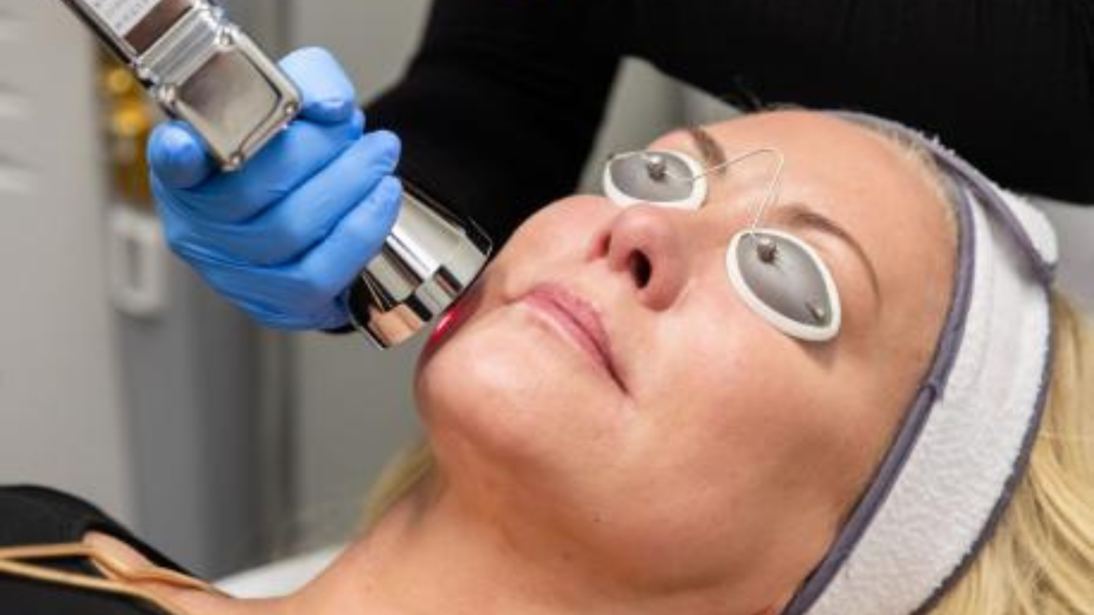 MicroLaser Peel | SkinDC | Arlington MicroLaser Peel